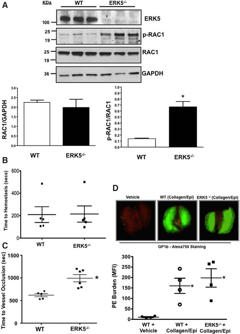 Figure 1 From Platelet Extracellular Regulated Protein Kinase 5 Is A