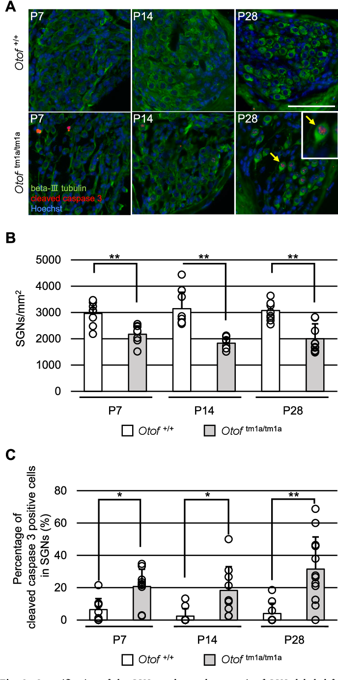 Figure 1 From Apoptosis Of Type I Spiral Ganglion Neuron Cells In Otof