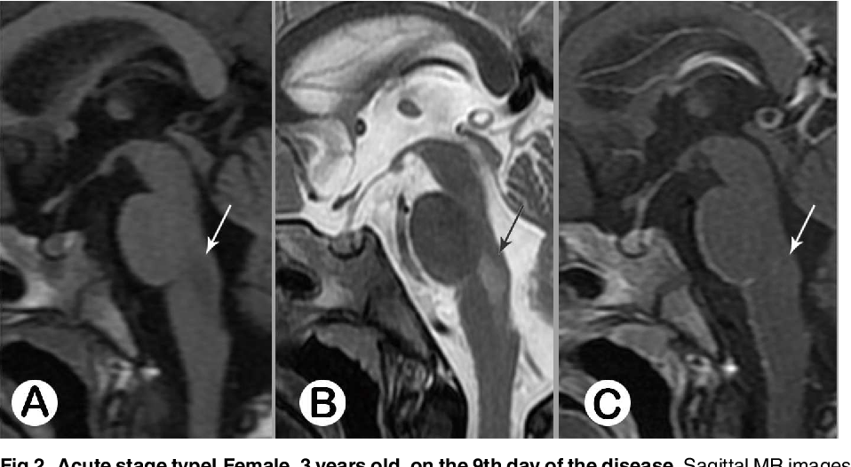 Figure 2 From New Findings Classification And Long Term Follow Up