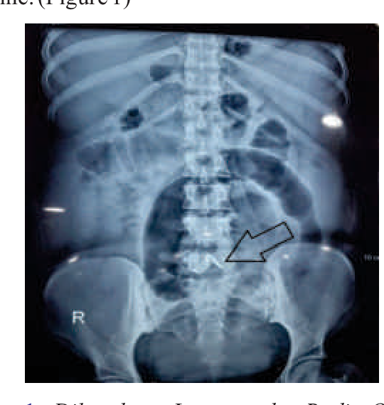 Figure 1 From Intraluminal Migration Of Gossypiboma And Rectal