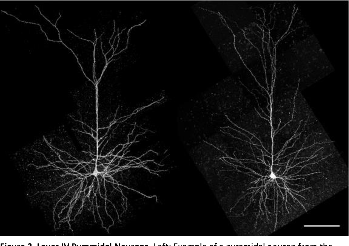 Figure 1 From Cholinergic Modulation Of Excitatory Synapses Of The Acc