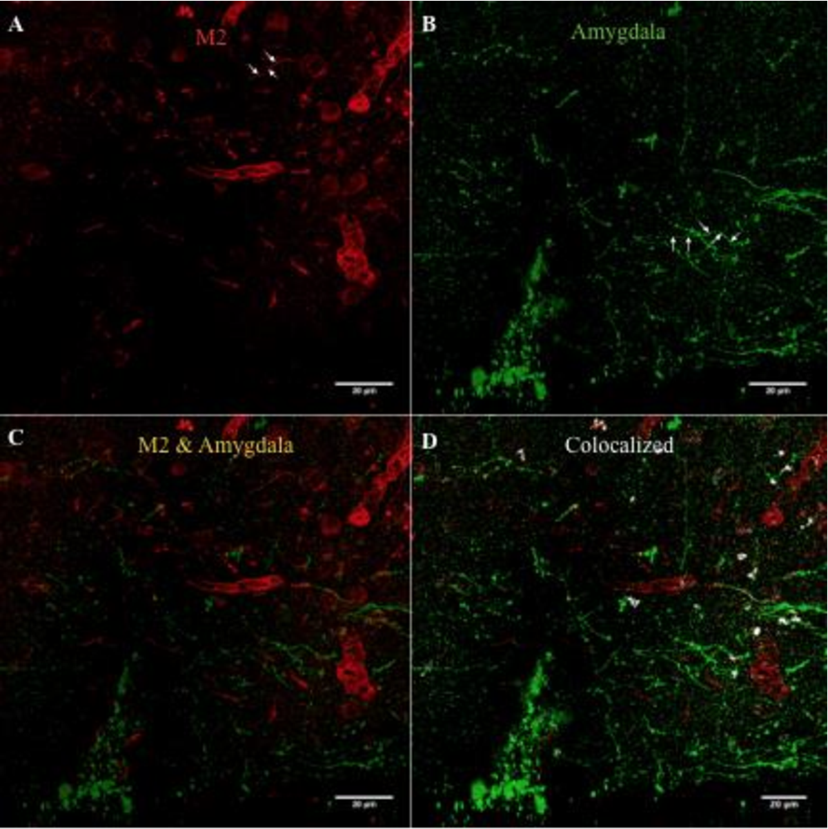 Figure 1 From Cholinergic Modulation Of Excitatory Synapses Of The Acc