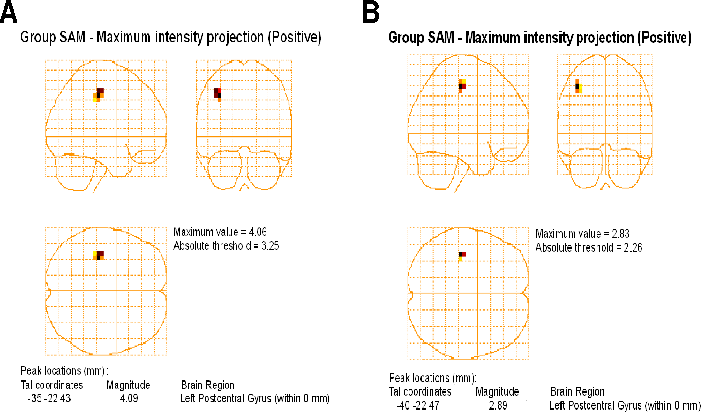 Figure 1 From Sex Differences In Sensorimotor Mu Rhythms During