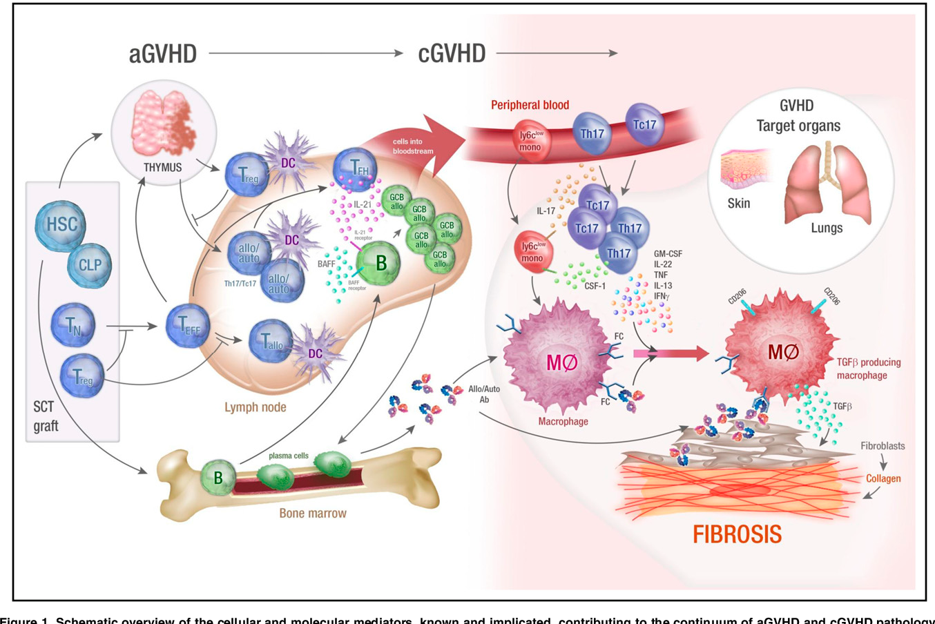 Pdf Series Chronic Graft Versus Host Disease Chronic Graft Versus