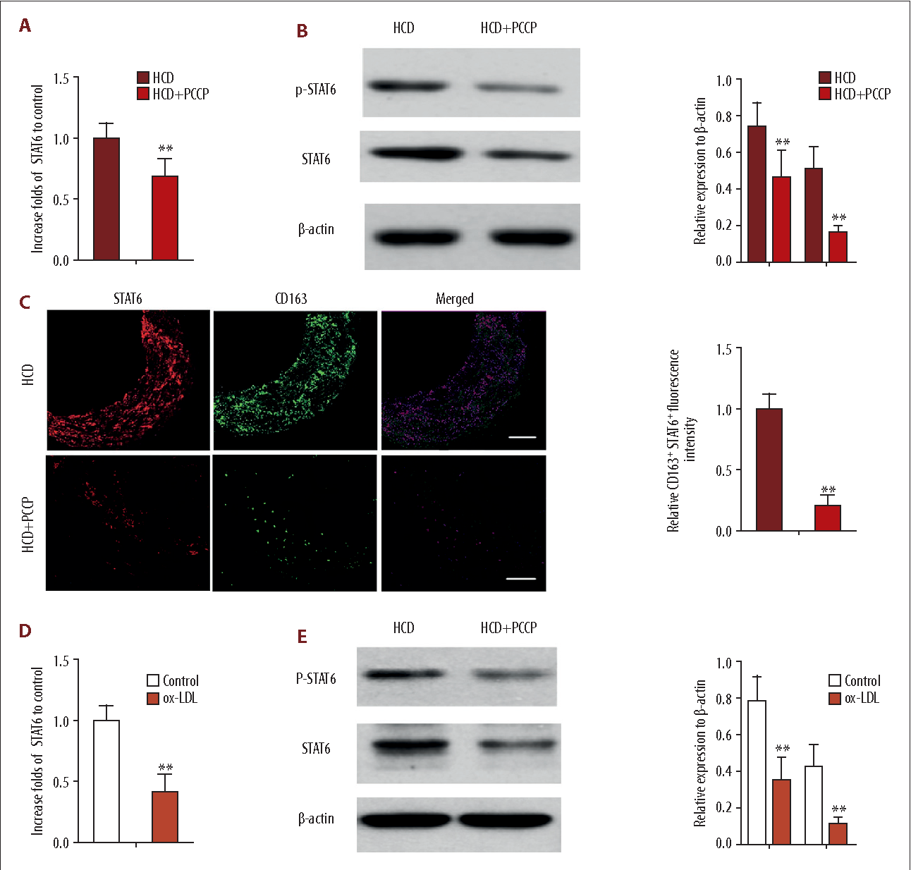 Figure 1 From Stat6 Upregulation Promotes M2 Macrophage Polarization To