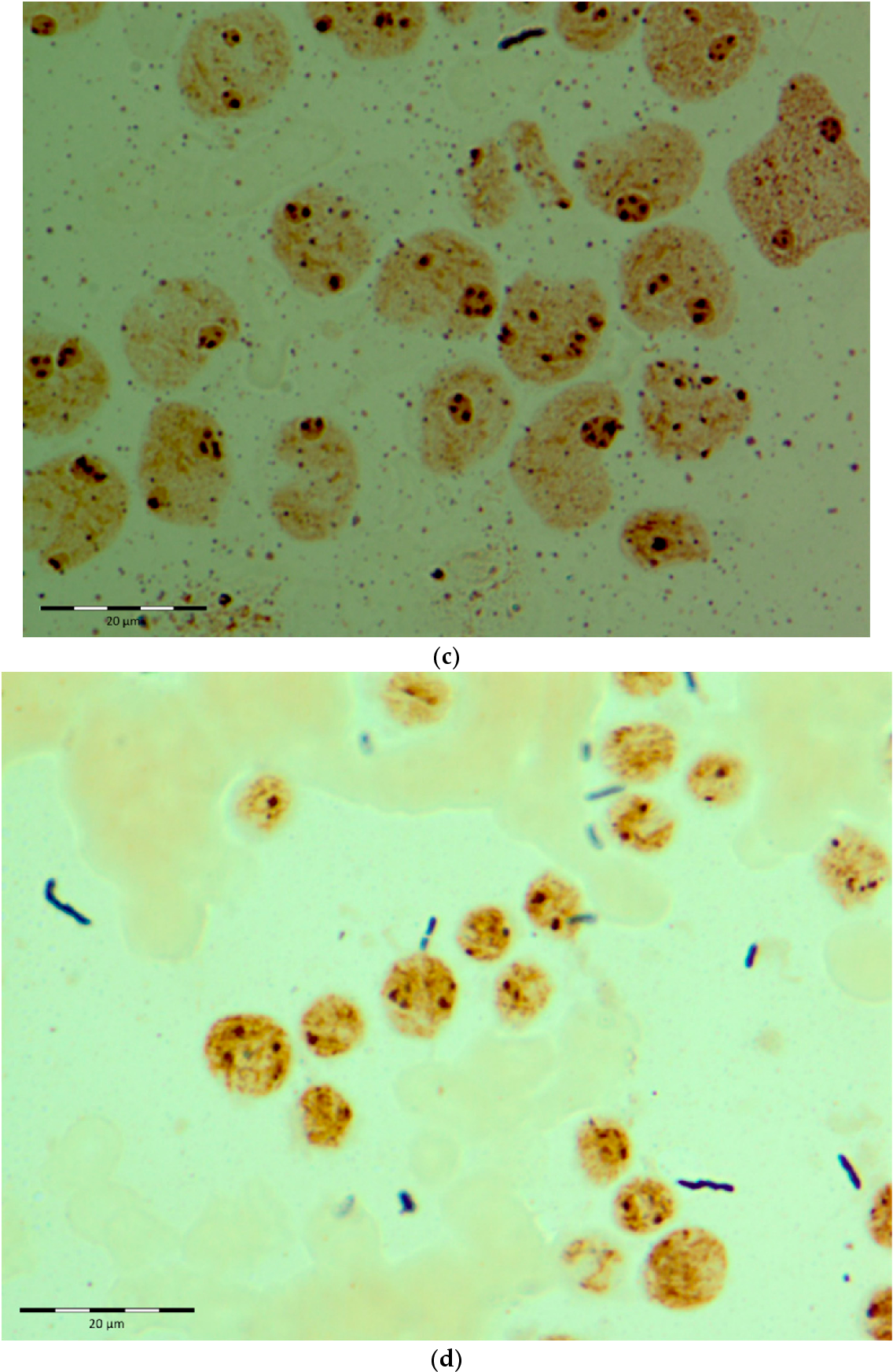 Figure 1 From Analysis Of Argyrophilic Nucleolar Organizer Regions