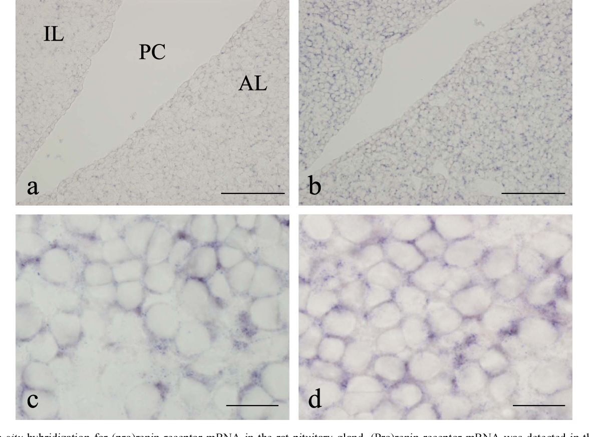 In Situ Hybridization Method Reveals Prorenin Receptor Expressing