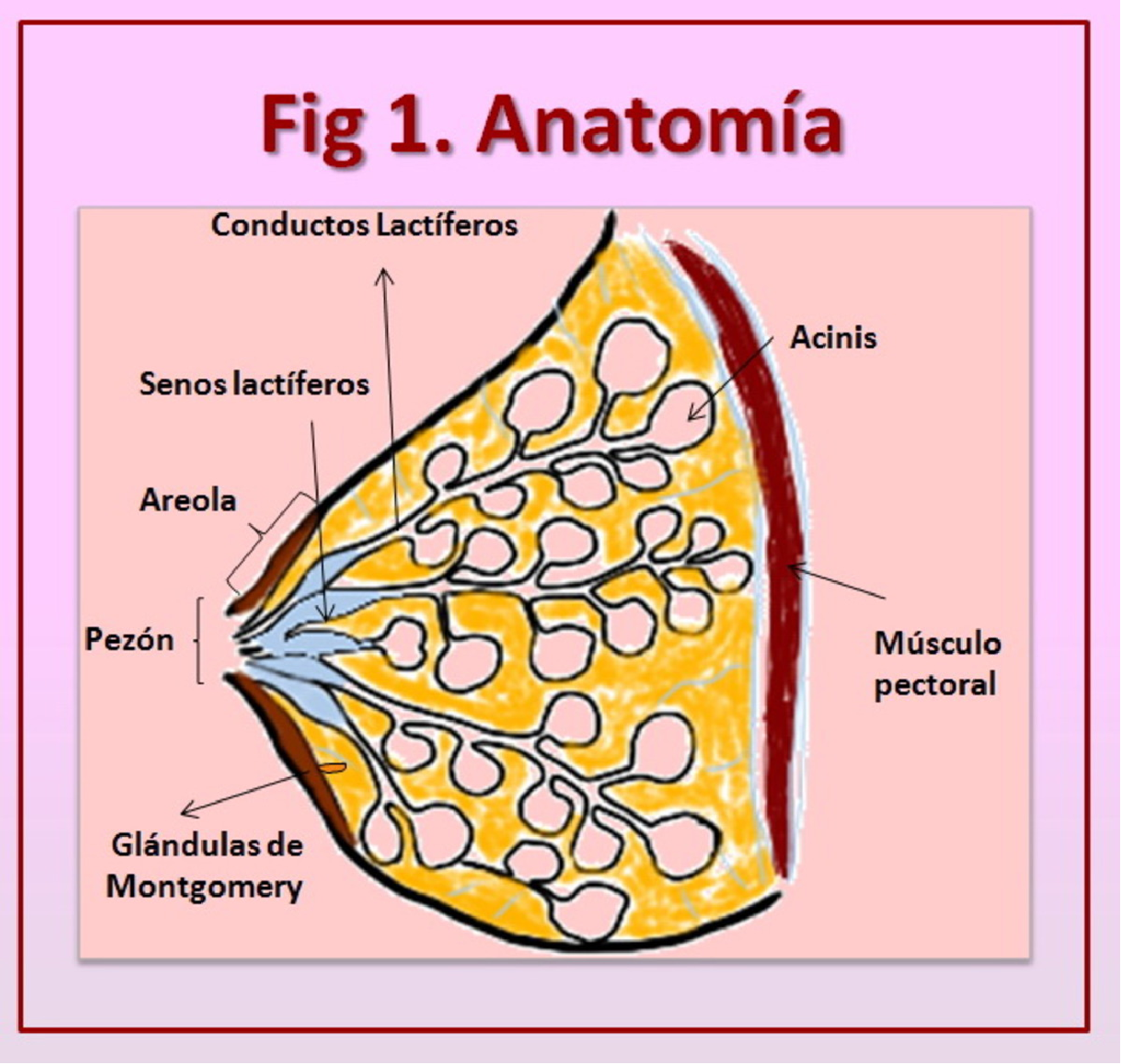 Figure 19 From Región Areola Pezón Hallazgos De Imagen Y