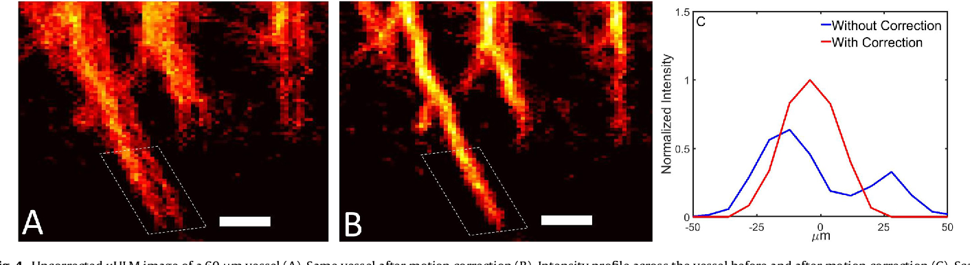 Figure 1 From Subwavelength Motion Correction For Ultrafast Ultrasound