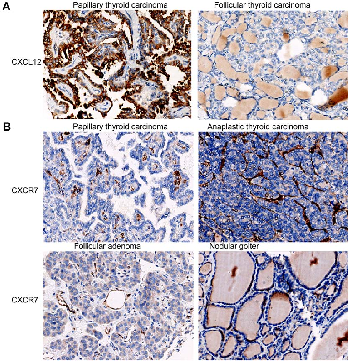 Figure 4 From Expression And Function Of Cxcl12cxcr4cxcr7 In Thyroid