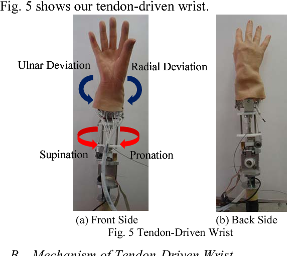 Development Of Prosthetic Arm With Pneumatic Prosthetic Hand And Tendon