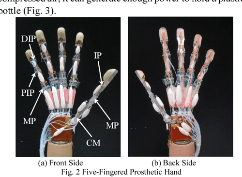 Development Of Prosthetic Arm With Pneumatic Prosthetic Hand And Tendon