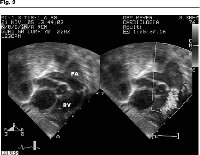 Figure 1 From Prenatal Diagnosis And Postnatal Outcome In Patients With