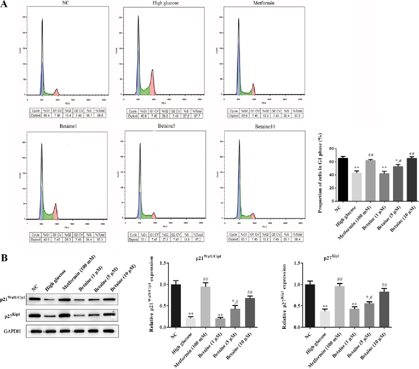 Pdf Betaine Alleviates High Glucose Induced Mesangial Cell