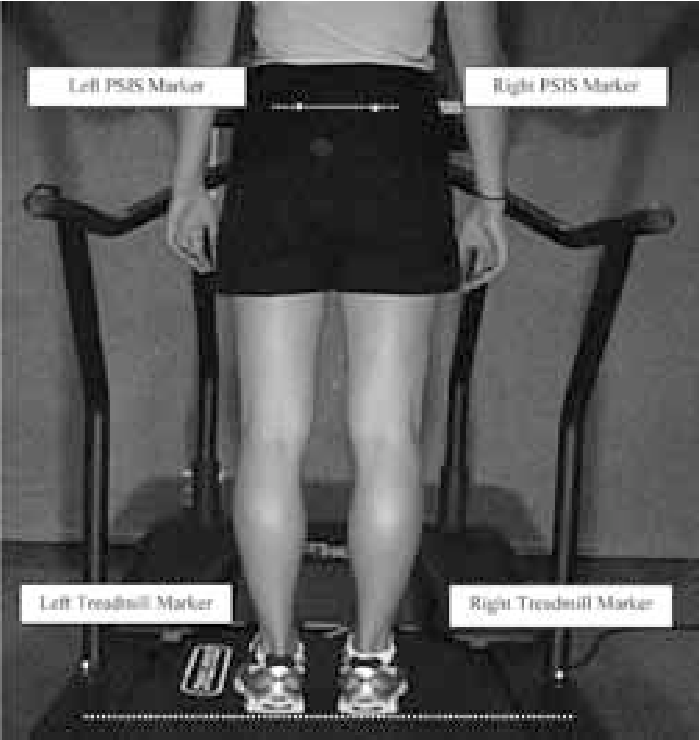 Figure 1 From The Relationship Between Hip Abductor Strength And The