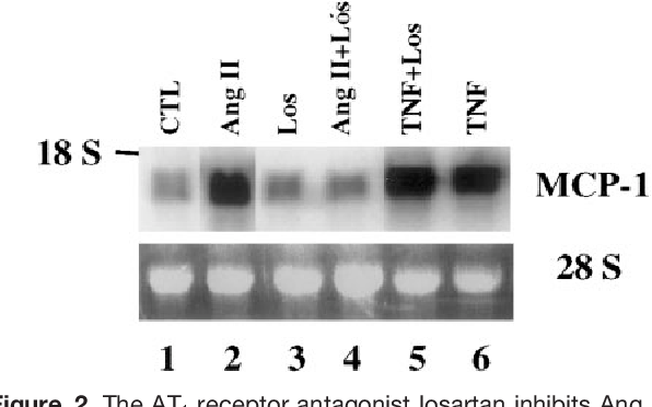 Figure 1 From Angiotensin Ii Induces Monocyte Chemoattractant Protein 1