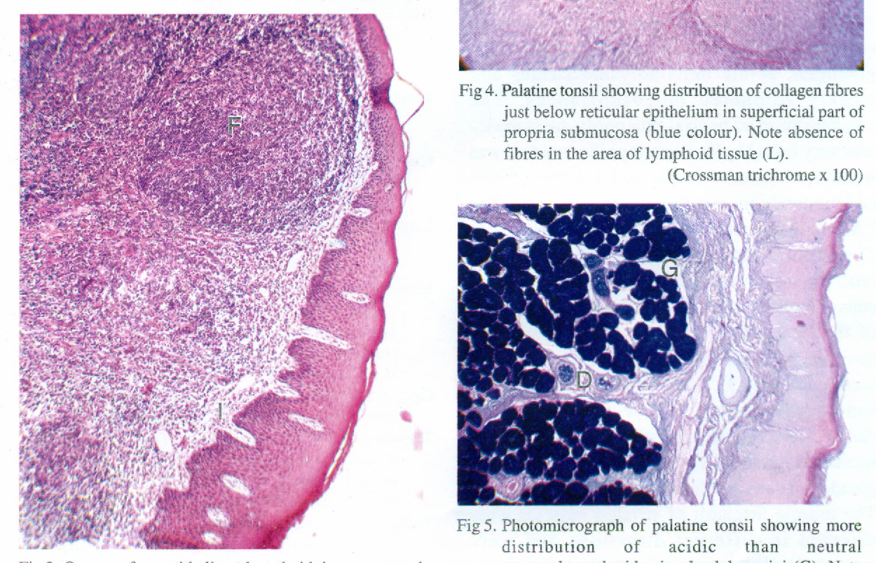 Pharyngeal Tonsils Histology Labeled