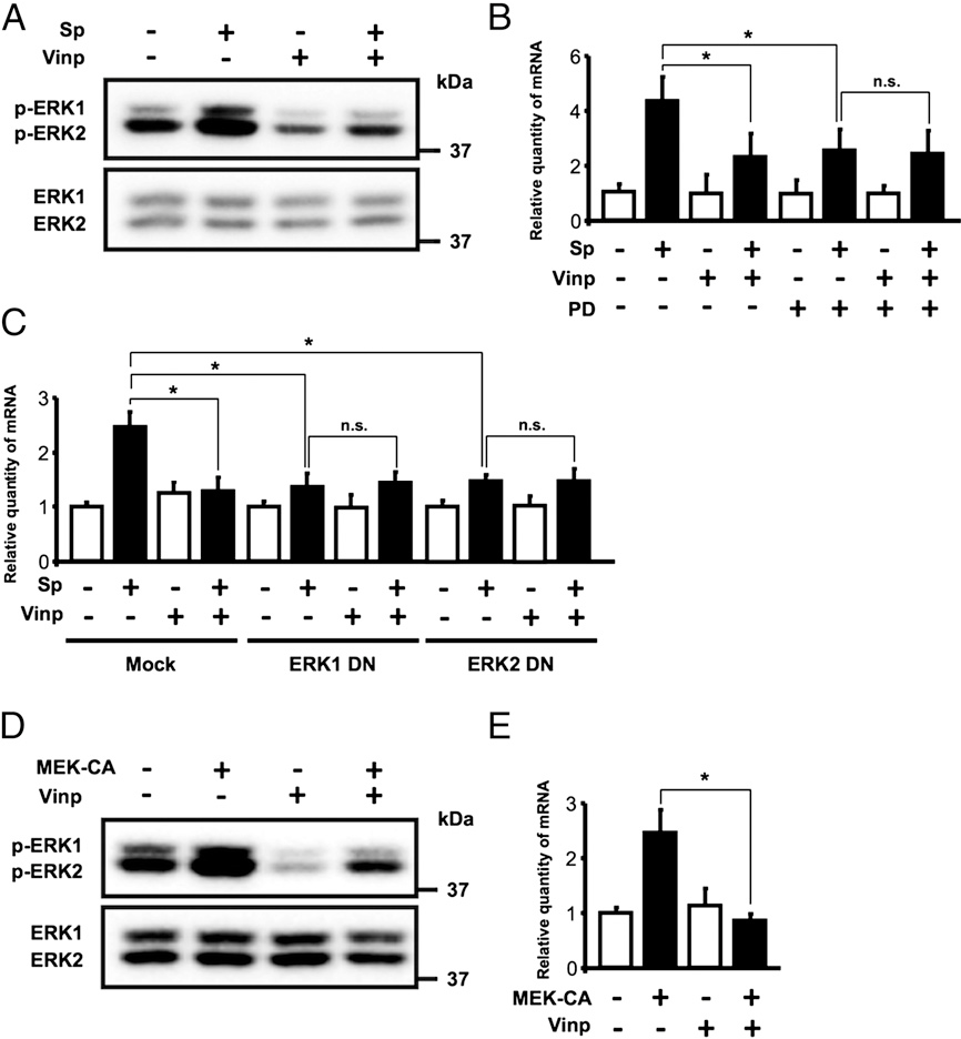 Figure 1 From Vinpocetine Inhibits Streptococcus Pneumoniaeinduced