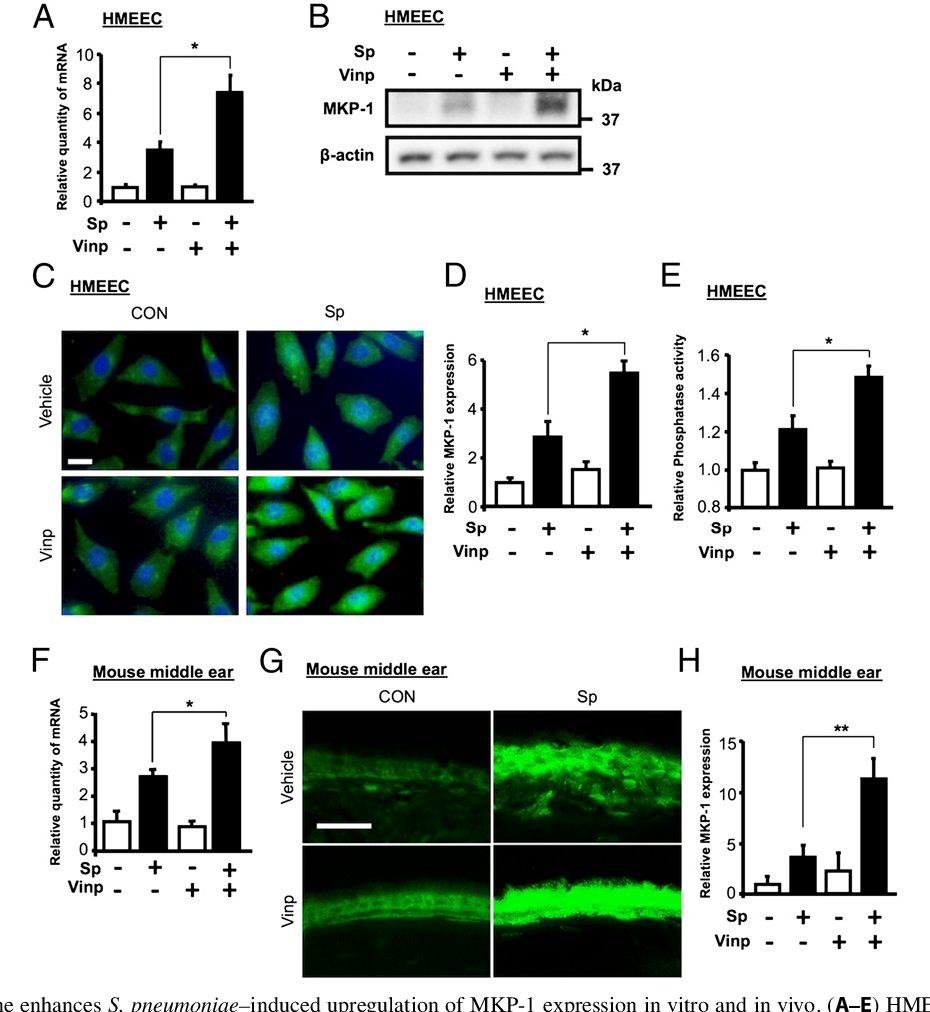 Figure 1 From Vinpocetine Inhibits Streptococcus Pneumoniaeinduced