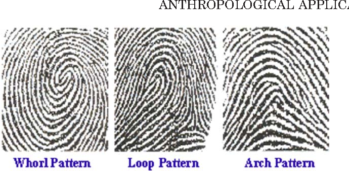 Figure 1 From Sex Ancestral And Pattern Type Variation Of Fingerprint