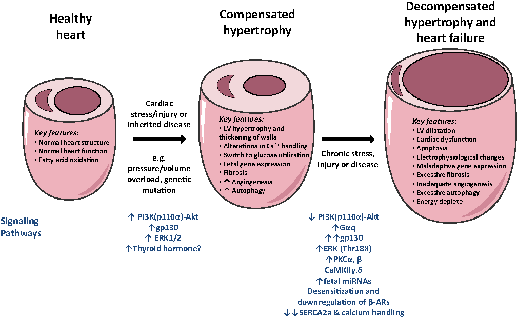 Pathophysiology Of Cardiac Hypertrophy And Heart Failure Signaling