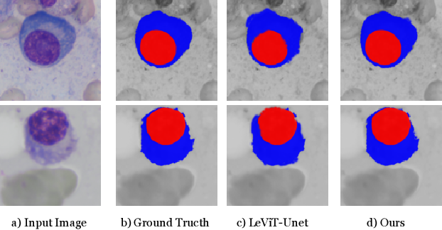 Figure 1 From Befunet A Hybrid Cnn Transformer Architecture For