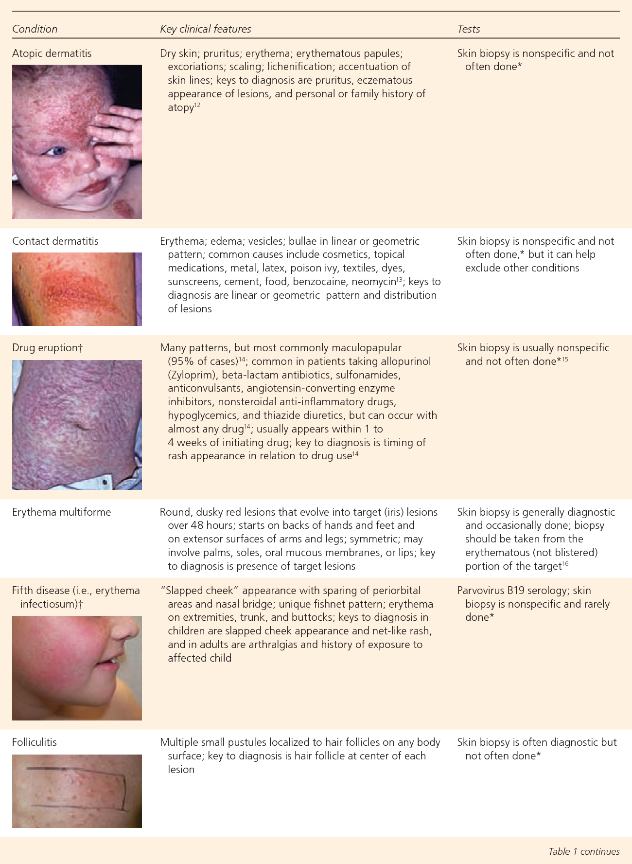 Papular Rash Differential