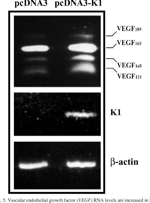 Figure 1 From The Kaposis Sarcoma Associated Herpesvirus Kshvhhv 8