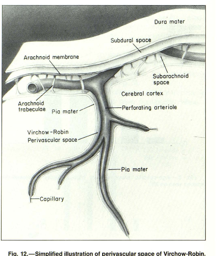 Pdf Large Virchow Robin Spaces Mr Clinical Correlation Semantic