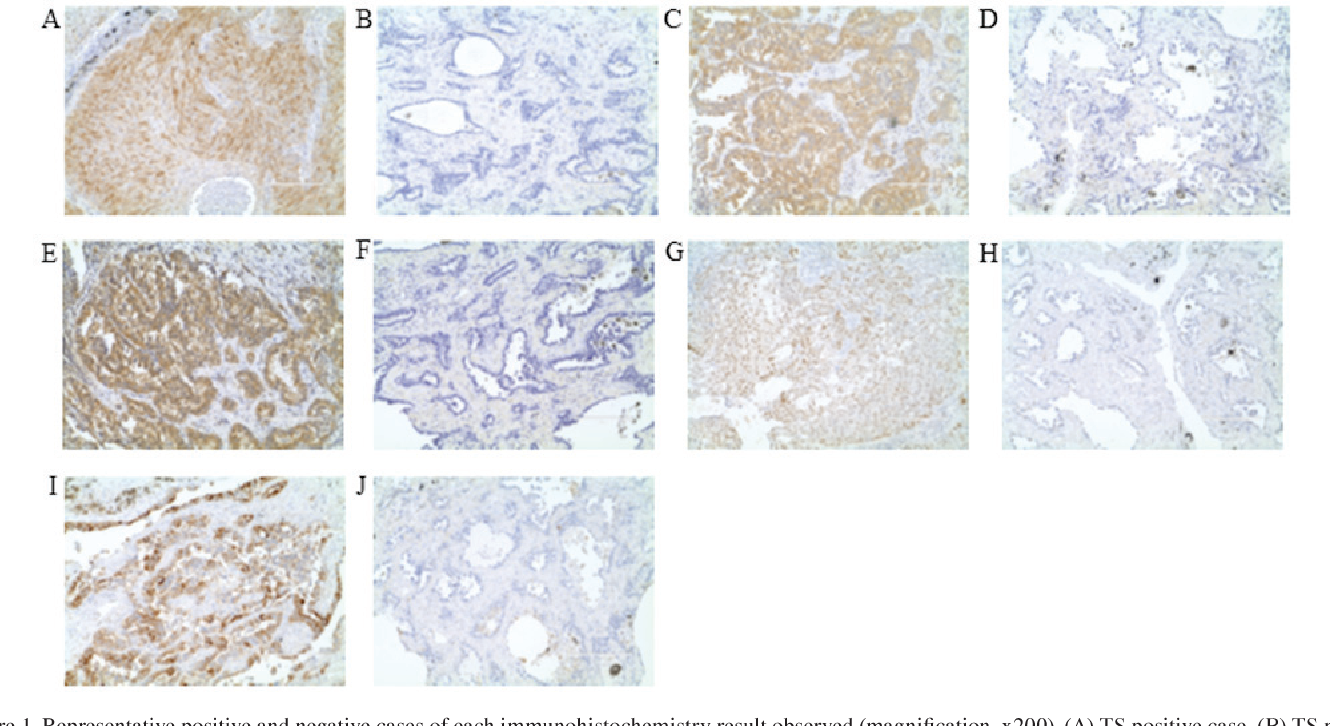 Figure 2 From The Relationship Between The Expression Of Thymidylate