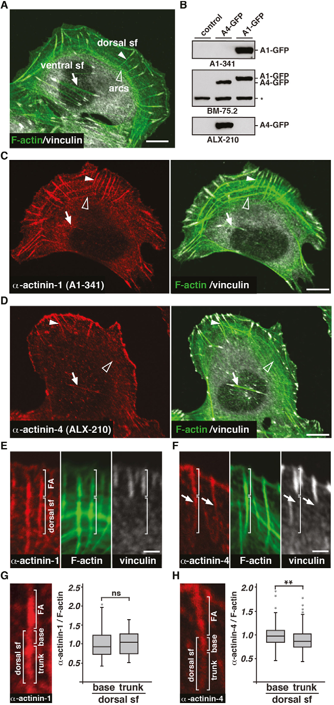 Figure 1 From Assembly Of Non Contractile Dorsal Stress Fibers Requires