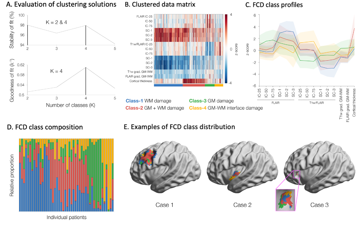 Figure 2 From Unsupervised Machine Learning Reveals Lesional