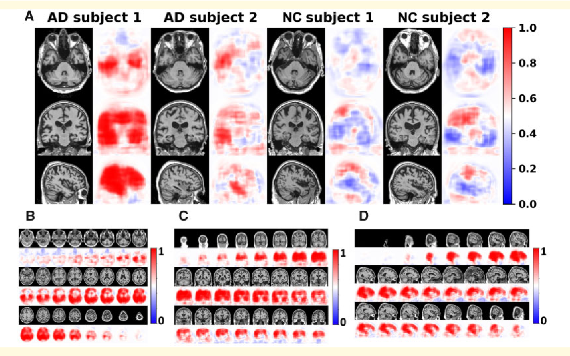 Pdf Development And Validation Of An Interpretable Deep Learning