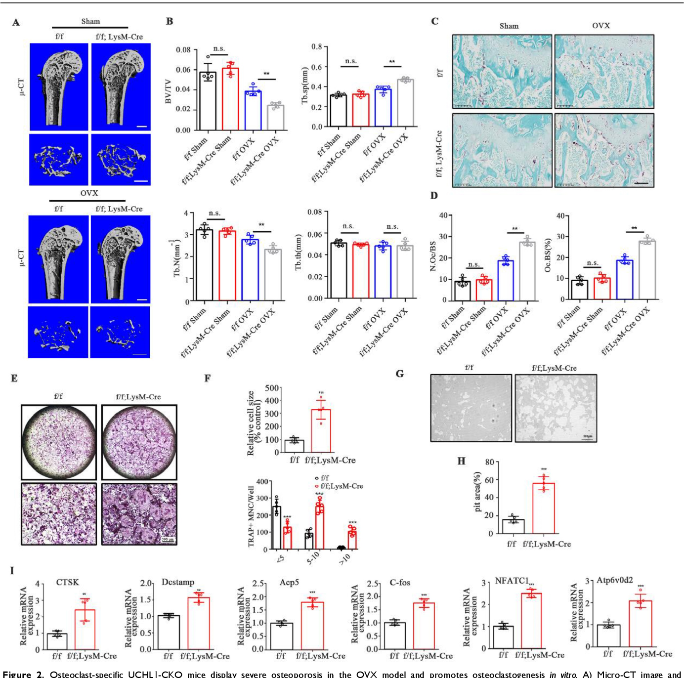 Pdf The Deubiquitinase Uchl1 Negatively Controls Osteoclastogenesis