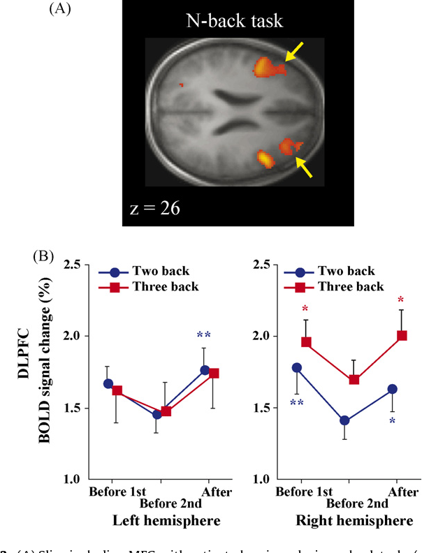 Figure 1 From Effects Of Chewing In Working Memory Processing