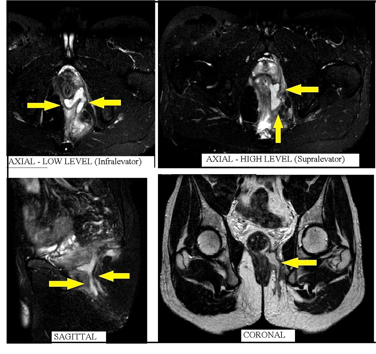 Magnetic Resonance Imaging Mri Operative Findings Correlation In 229