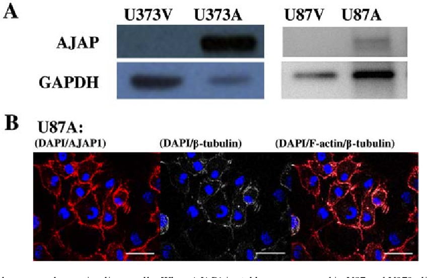 Figure 1 From Ajap1 Expression Modulates Glioma Cell Motility And