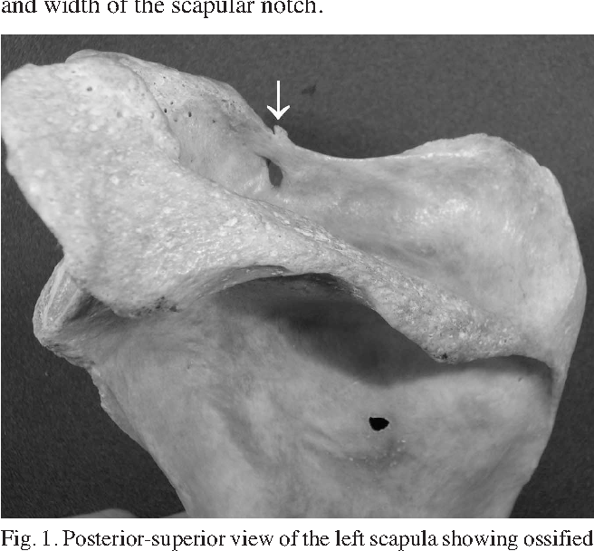 Pdf High Incidence Of Complete Ossification Of The Superior