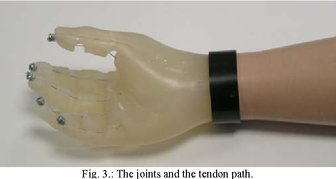 Figure 2 From A Cosmetic Prosthetic Hand With Tendon Driven Under