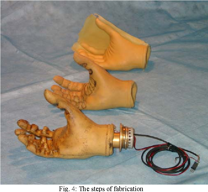 Figure 6 From A Cosmetic Prosthetic Hand With Tendon Driven Under