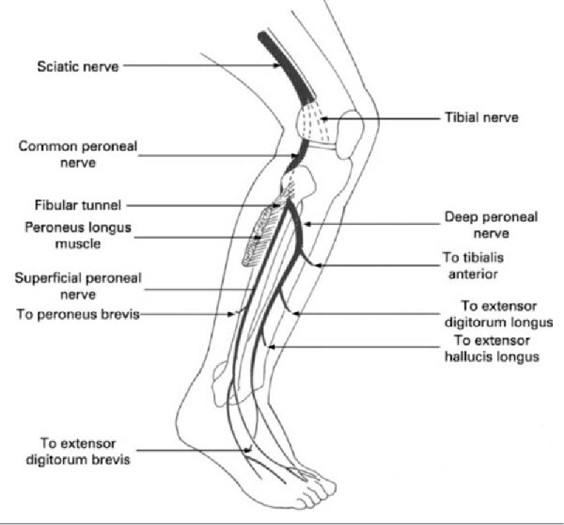 Pdf Transient Superficial Peroneal Nerve Palsy After Anterior