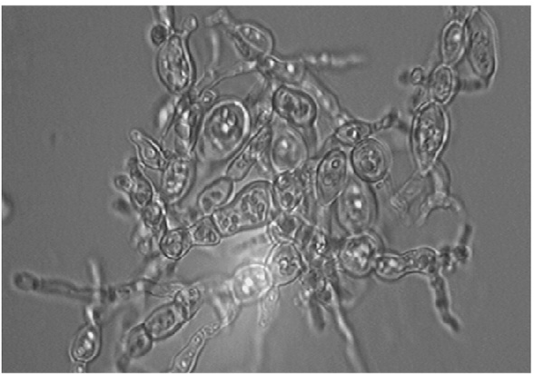 Figure 1 From Advances In Citric Acid Fermentation By Aspergillus Niger