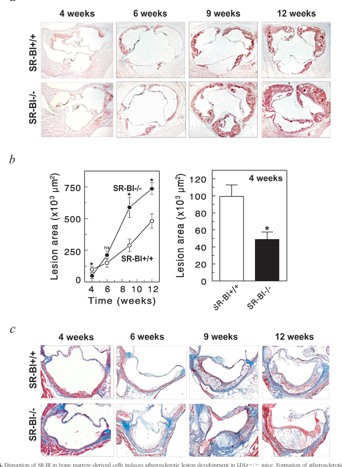 Dual Role For Scavenger Receptor Class B Type I On Bone Marrow Derived