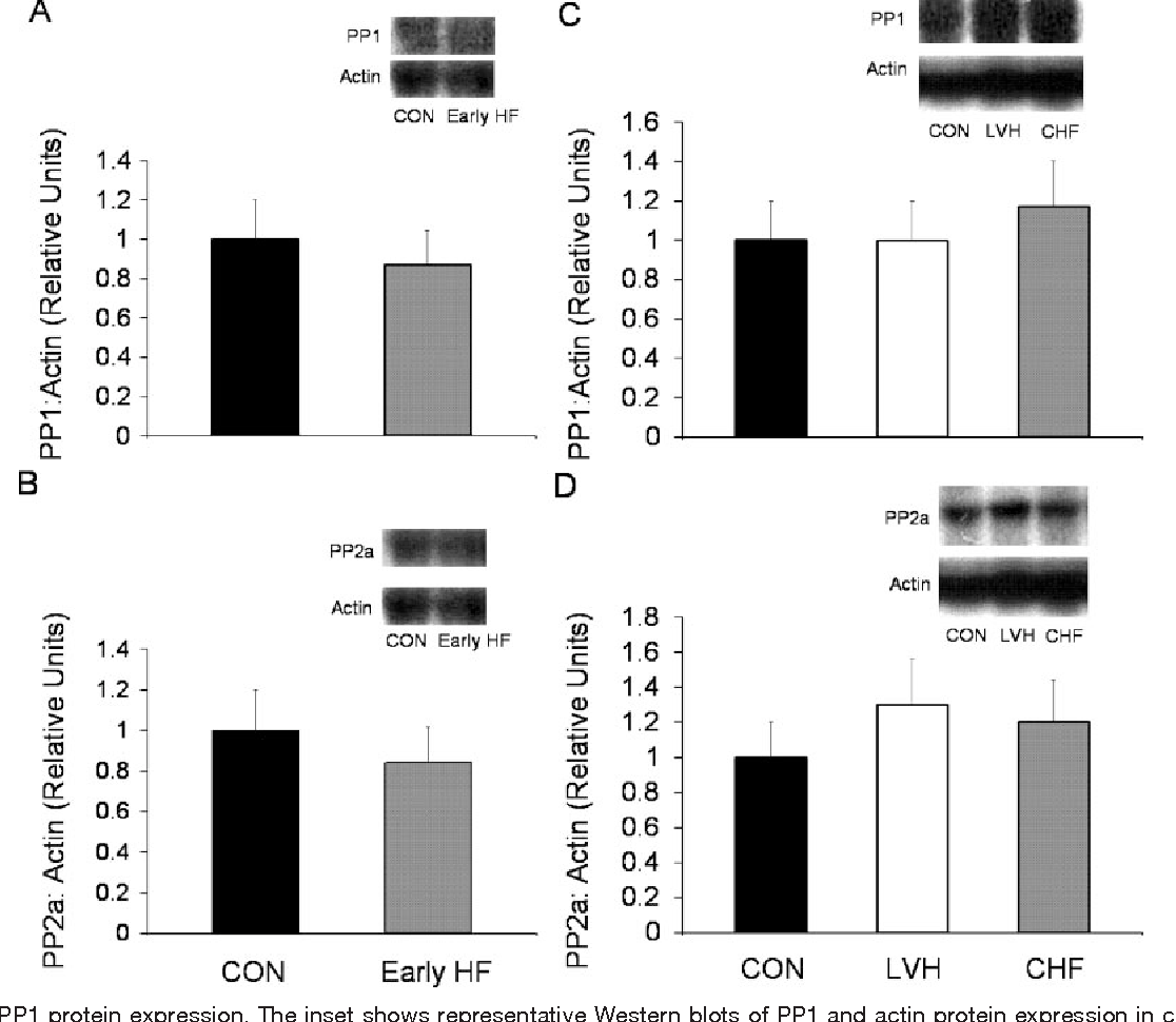 Figure 1 From Augmented Protein Kinase C αinduced Myofilament Protein