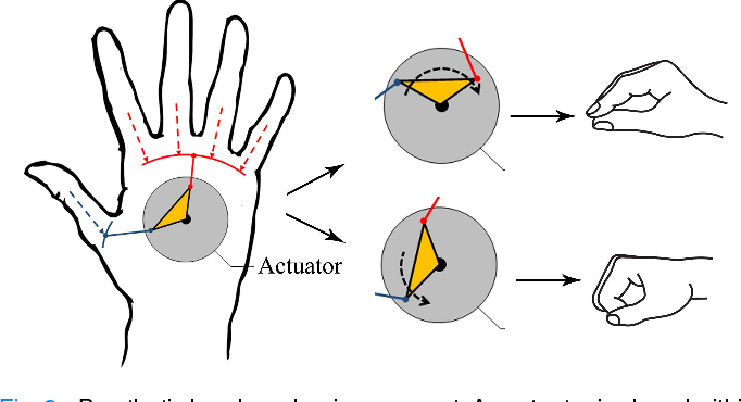 Figure 6 From Design Of Multi Grip Patterns Prosthetic Hand With Single