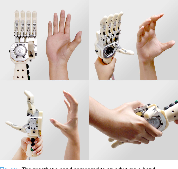 Design Of Multi Grip Patterns Prosthetic Hand With Single Actuator