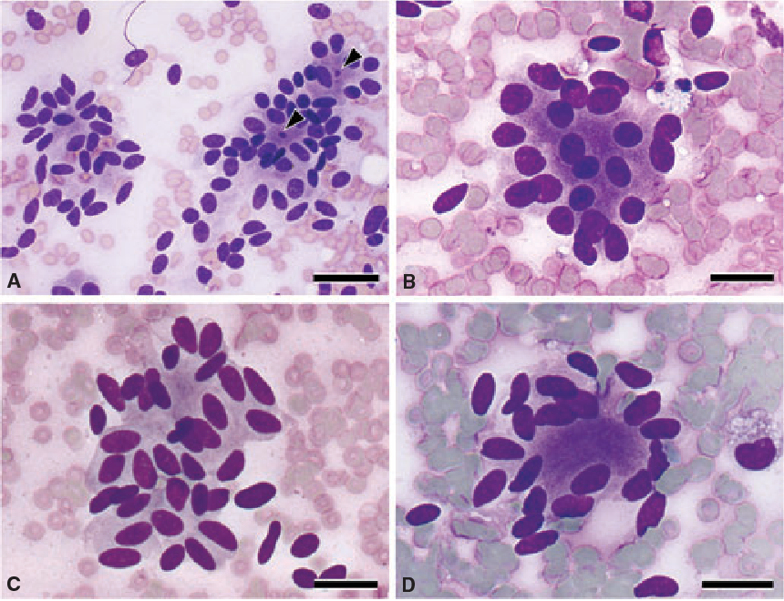 Figure 1 From Cytologically Atypical Anal Sac Adenocarcinoma In A Dog