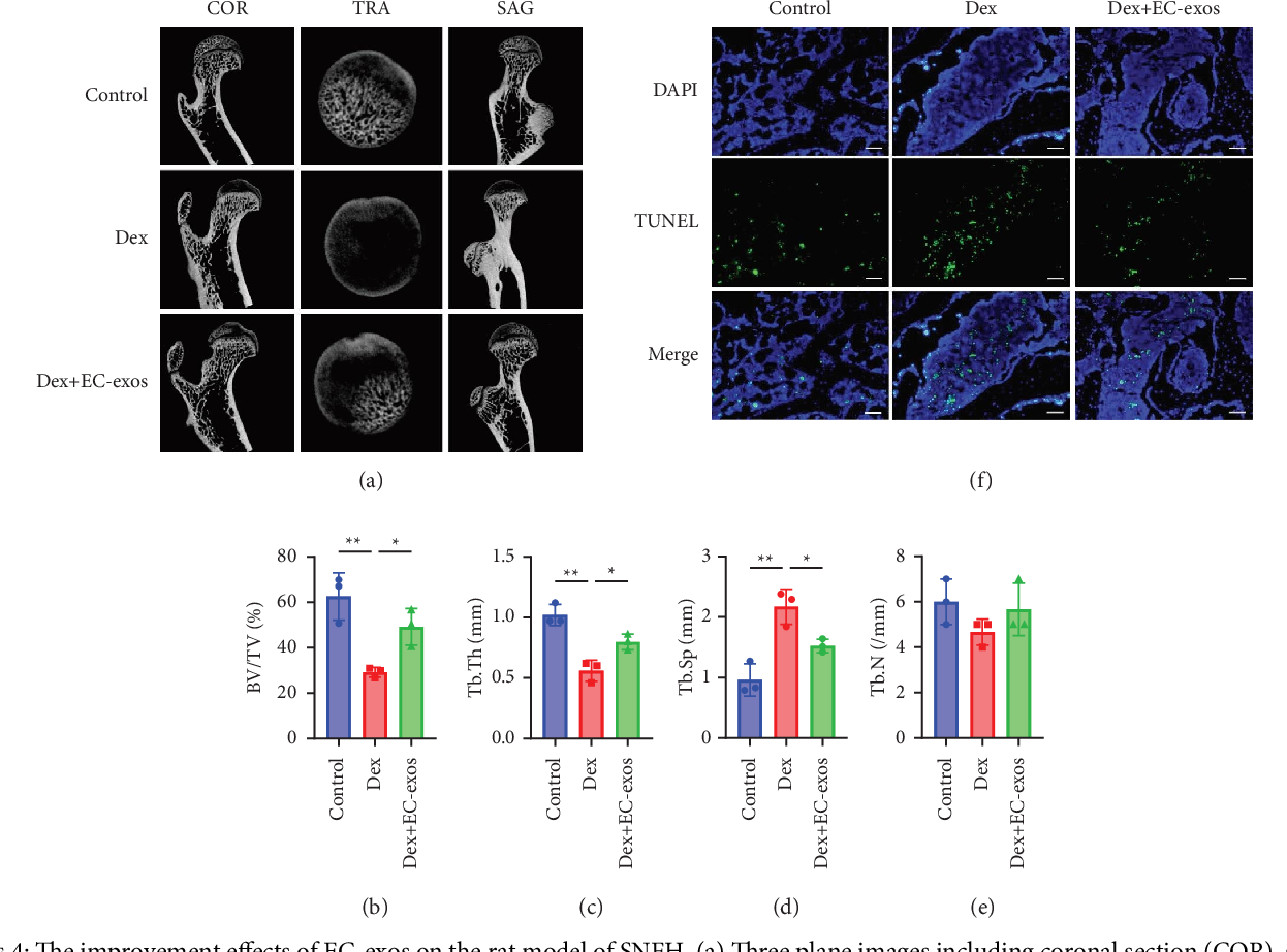 Figure 1 From Endothelial Cell Derived Exosomes Inhibit Osteoblast