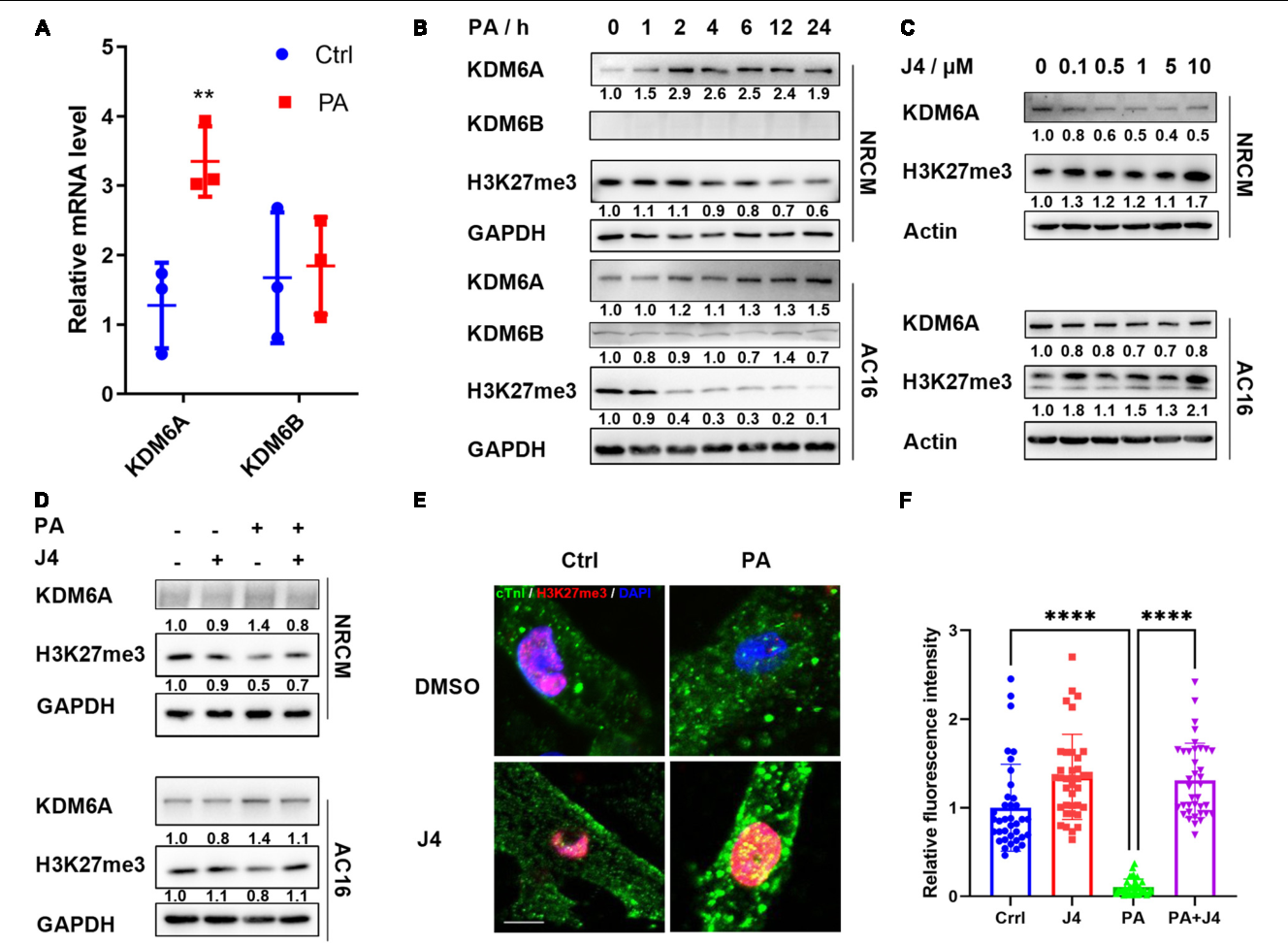 Figure 4 From Gsk J4 A Specific Histone Lysine Demethylase 6a