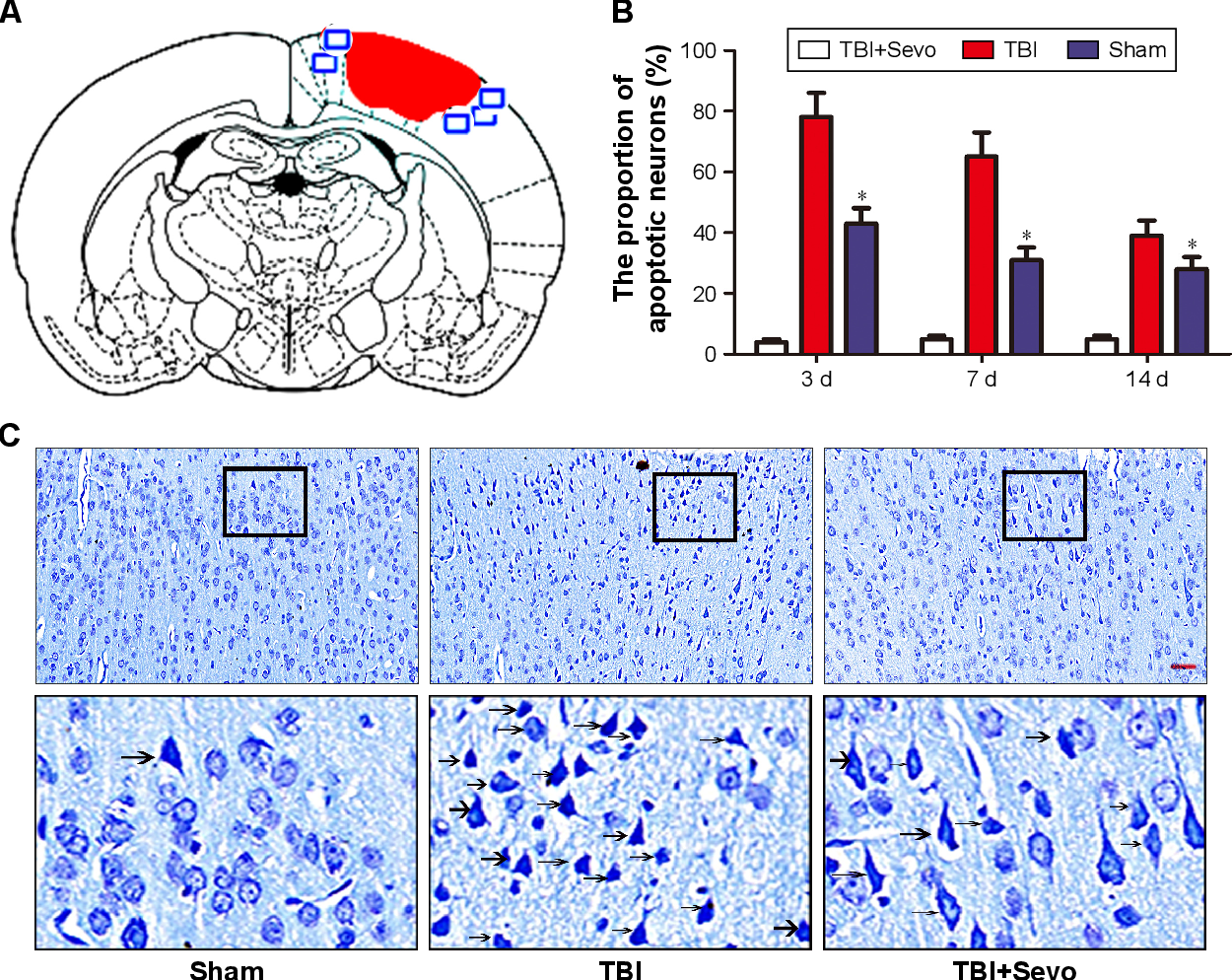 Pdf Sevoflurane Post Conditioning Attenuates Traumatic Brain Injury